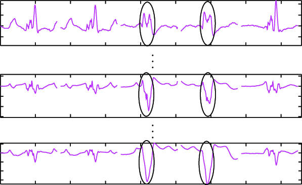آریتمی قلب | تشخیص، عوامل و خطرات - مرکز قلب، عروق و اکوکاردیوگرافی ...